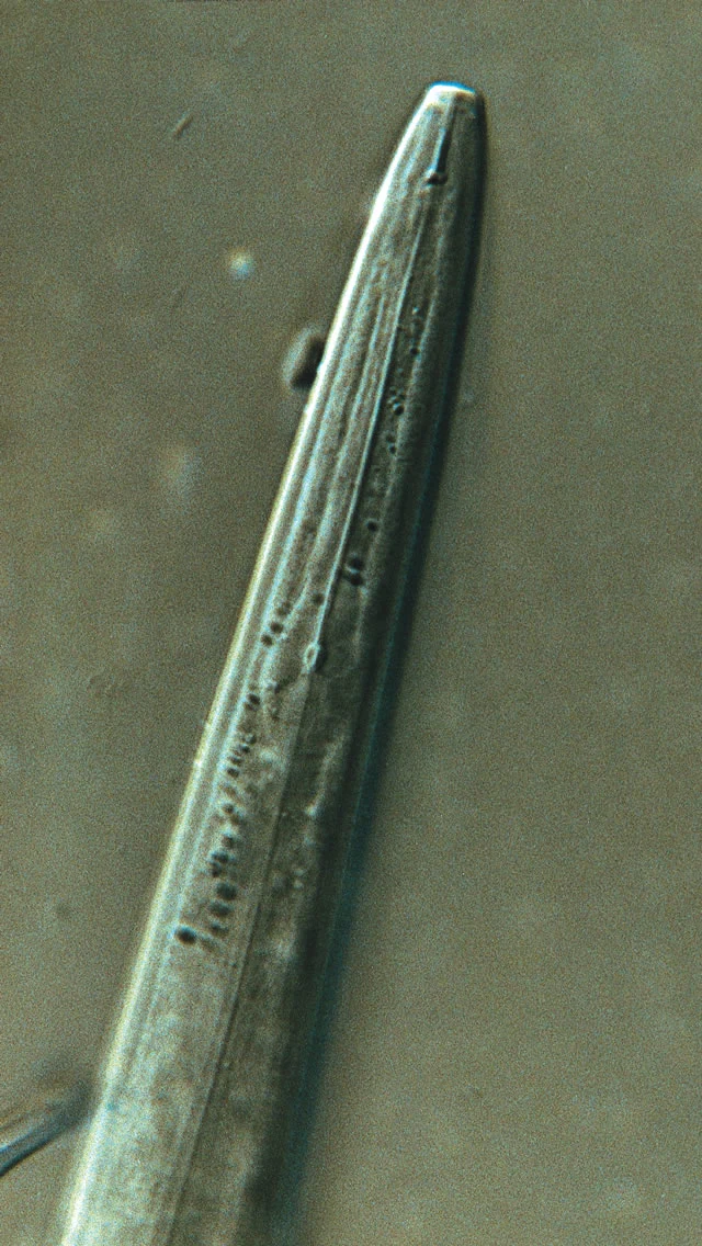 Stem and Bulb nematodes