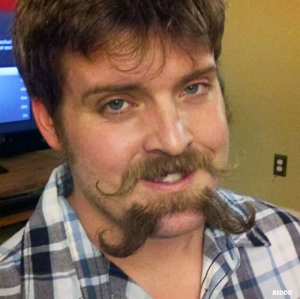 People Are Growing 'Double Moustaches' In Bizarre New Trend | TOTUM