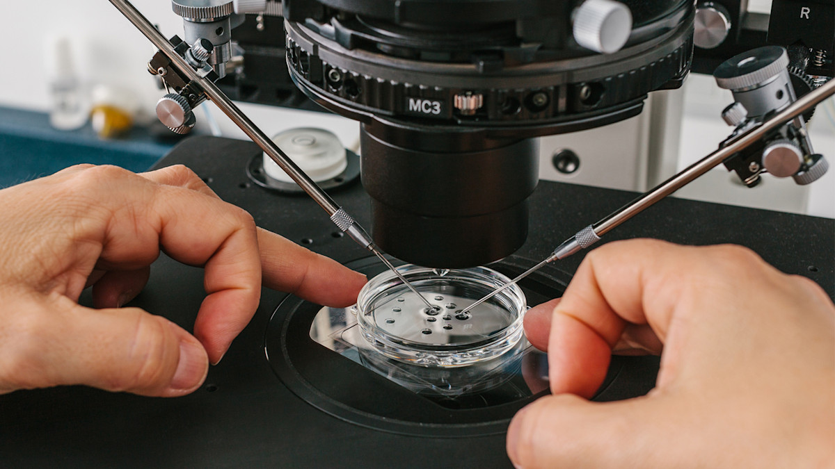 What Is ICSI - FertilityIQ