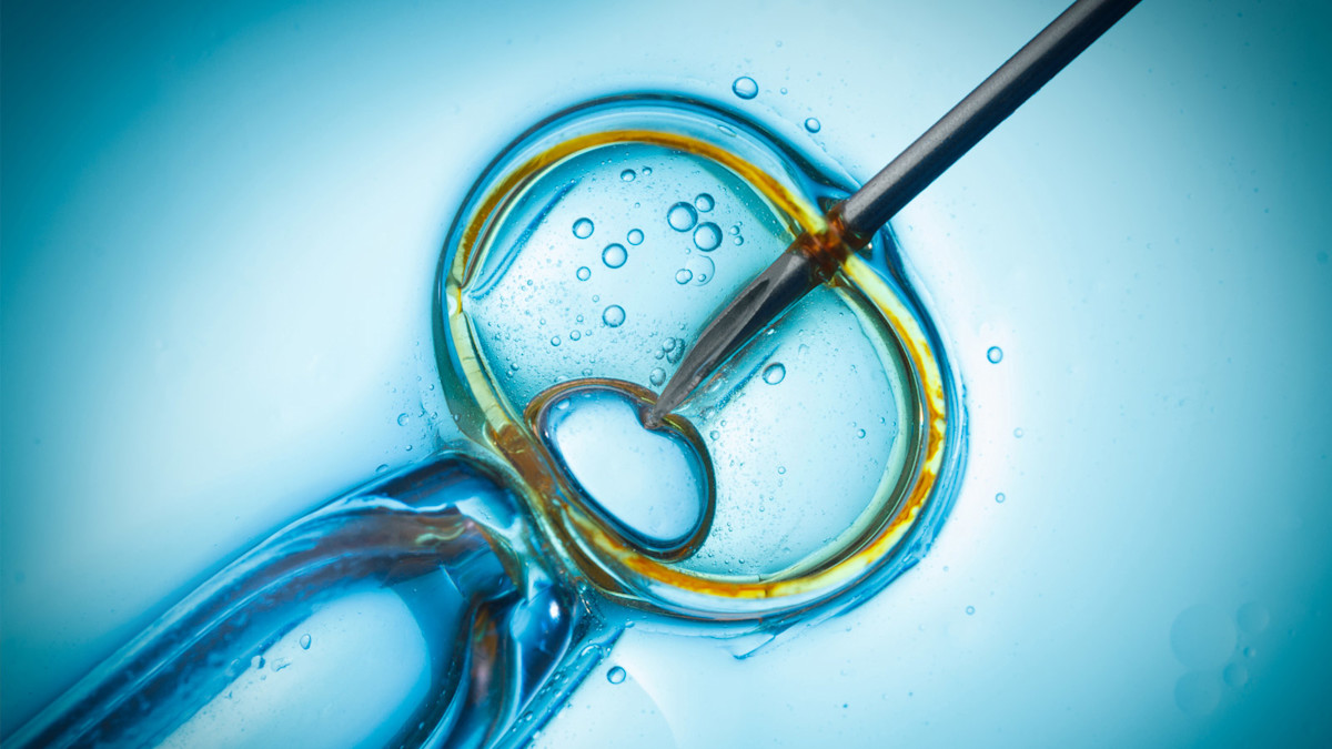 Understanding ICSI's Costs - FertilityIQ