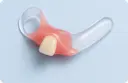 What is a dental flipper? Flipper tooth vs. implant tooth | ClearChoice