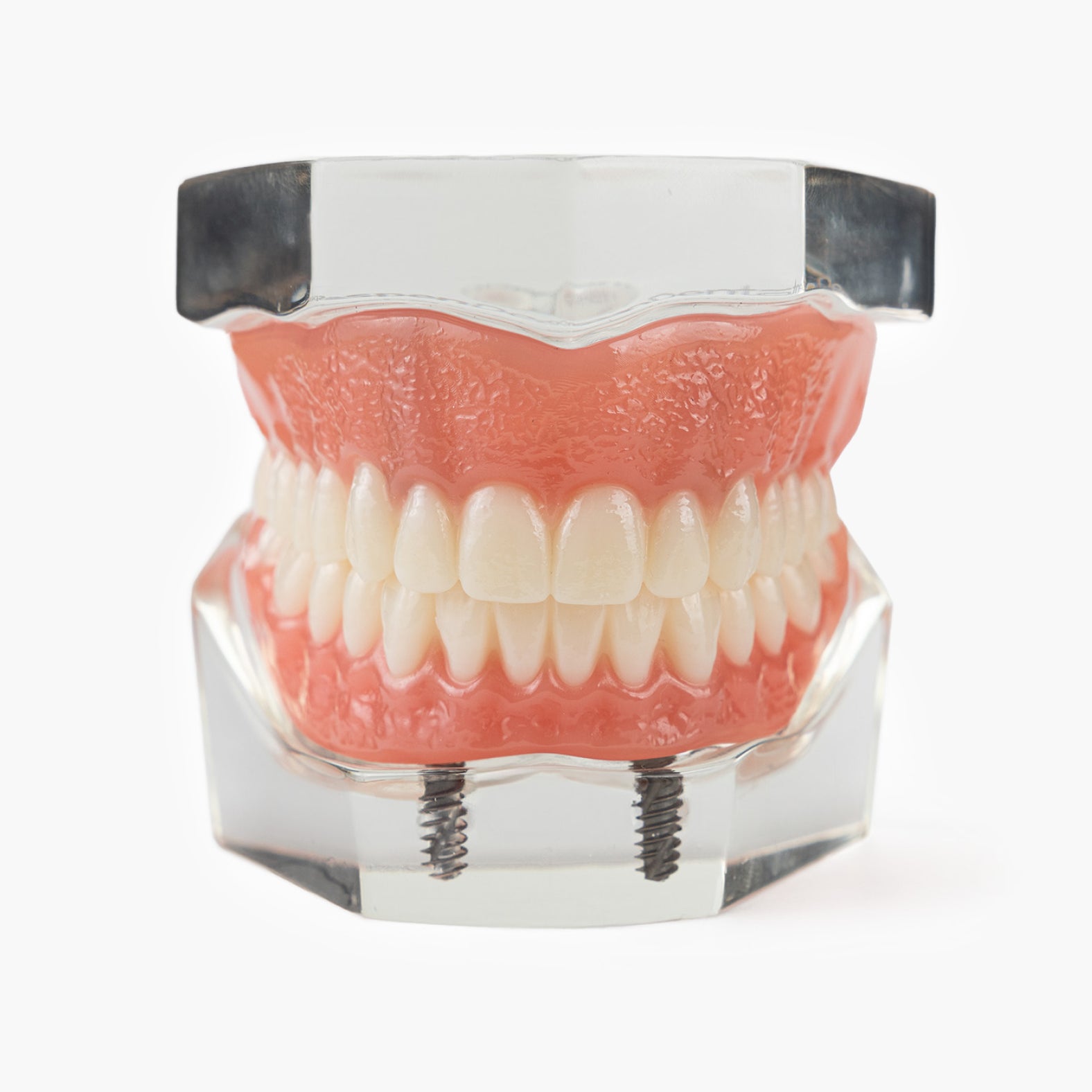 Implant Dentures – Secure, Natural-Looking Tooth Replacement | Aspen Dental
