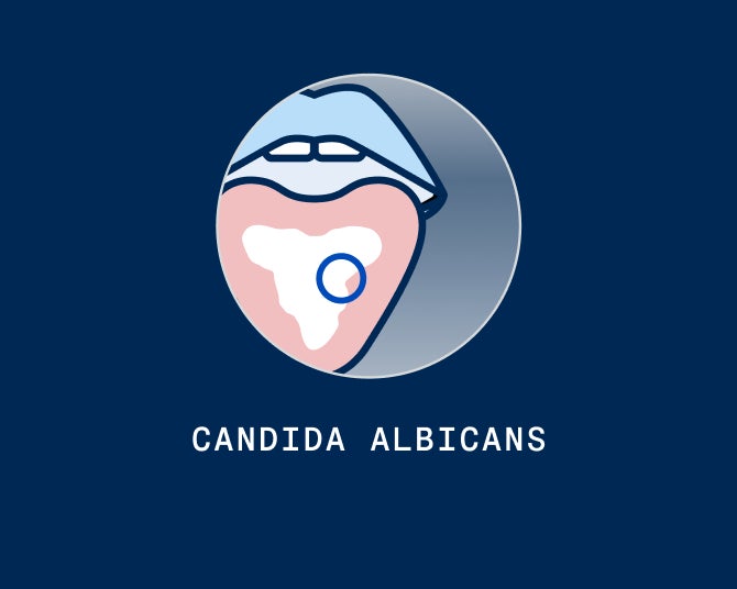 Managing Oral Thrush: Symptoms, Causes & Preventative Care