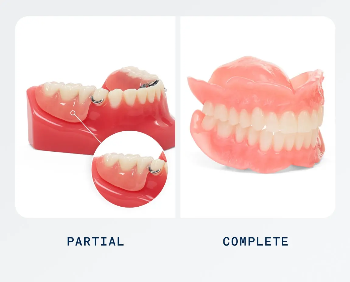 Benefits of upper and lower partial dentures | Aspen Dental