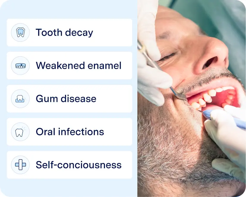 Black teeth: stains, causes, risks and treatment | Aspen Dental