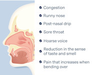 Can A Sinus Infection Cause Tooth Pain Aspen Dental