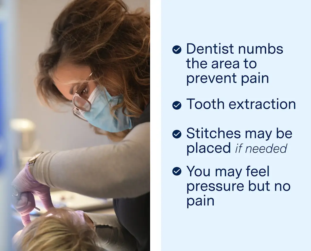 How long does a tooth extraction take? | Aspen Dental