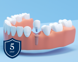 Denture and Implant Warranties | Aspen Dental