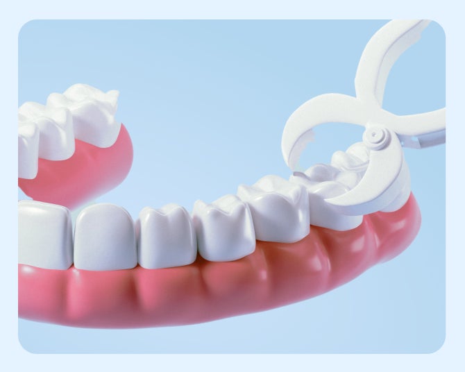 Tooth Extraction in Glenmont, NY | Aspen Dental