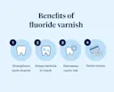 How Long Will Your Fluoride Varnish Treatment Last? | Aspen Dental