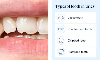 Effective ways to fix a broken tooth | Aspen Dental