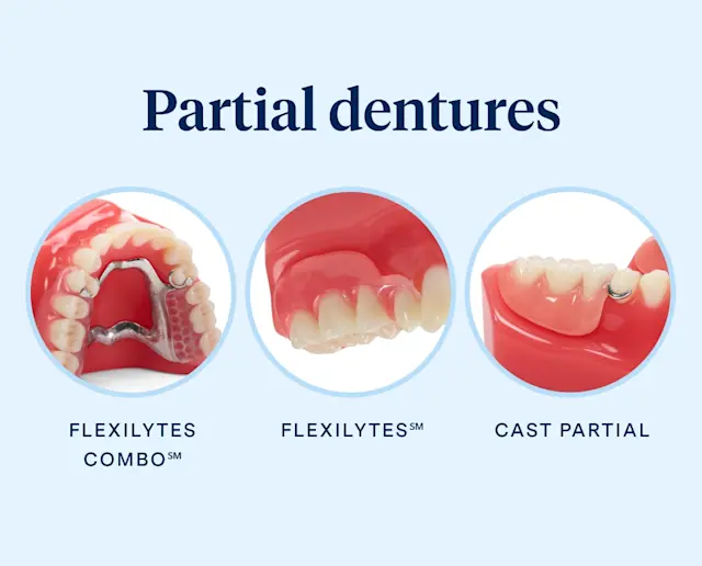 Benefits of upper and lower partial dentures | Aspen Dental