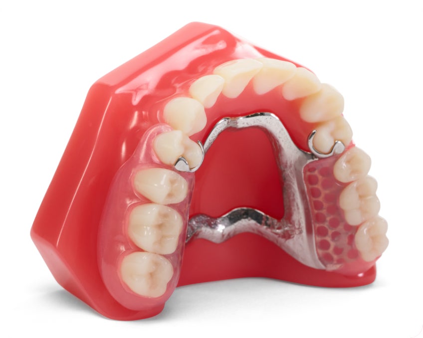 Partial Dentures Cost: Custom, Affordable Options | Aspen Dental