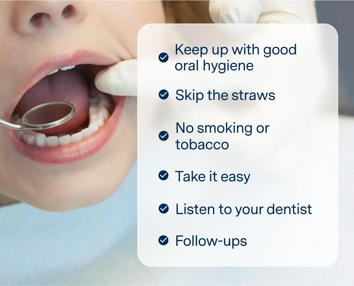 Dry socket: causes, symptoms, treatment and prevention | Aspen Dental