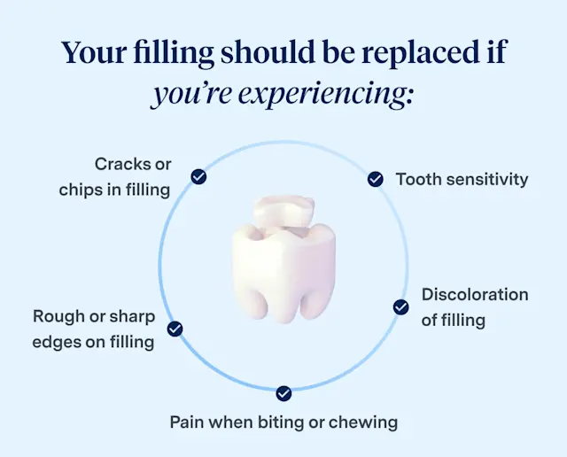 How Long Do Dental Fillings Last? | Aspen Dental