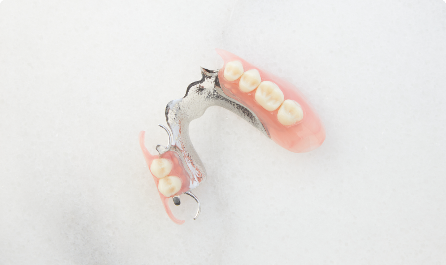 Removable Partial Denture Upper