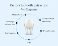 Pulling A Molar Tooth Pulling A Molar Tooth