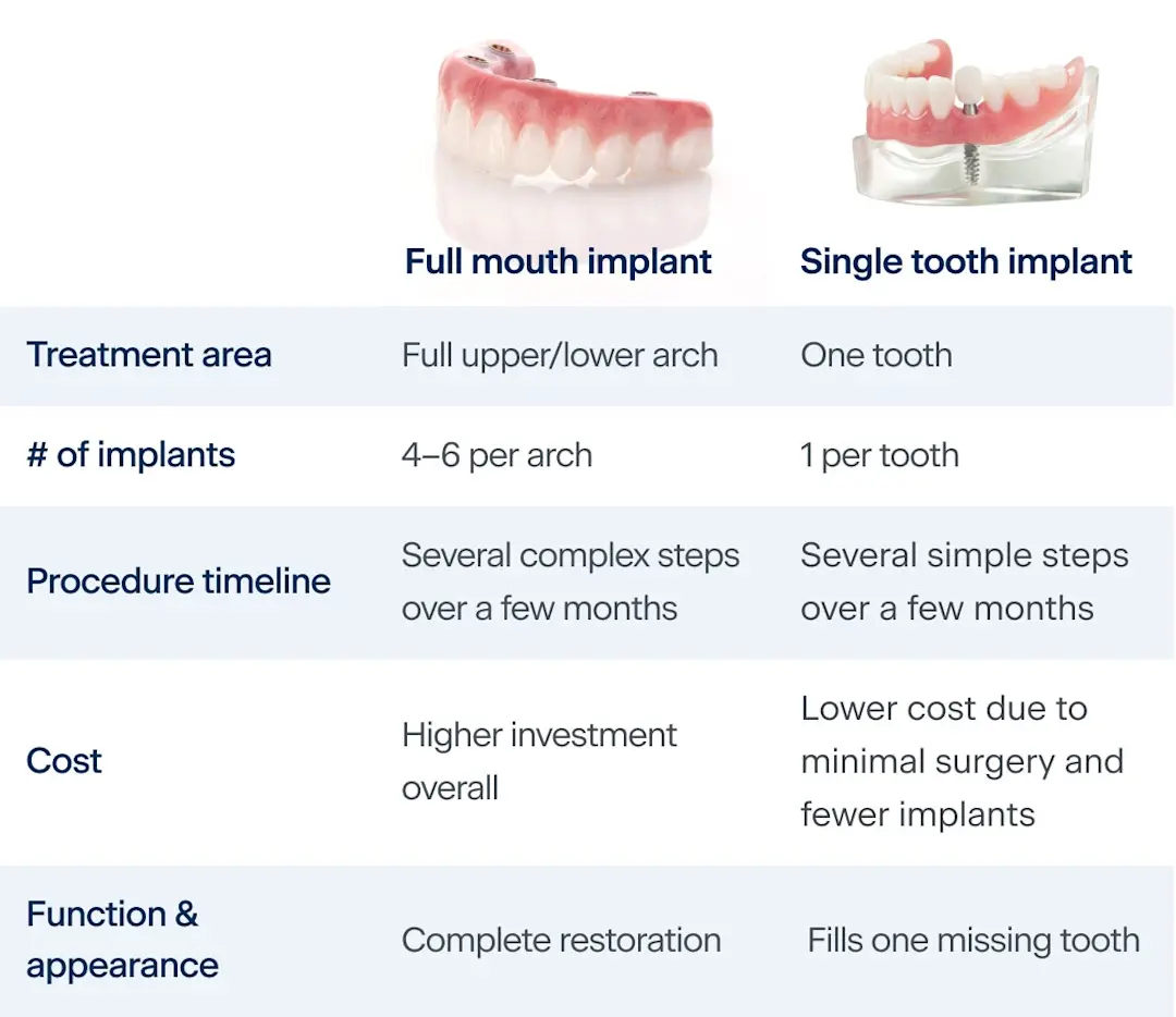 Full mouth dental implants or single tooth implants: What’s right for ...