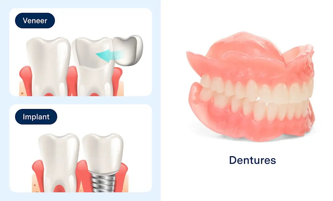 Veneers vs. Dentures: Choose the Best Option for Your Smile