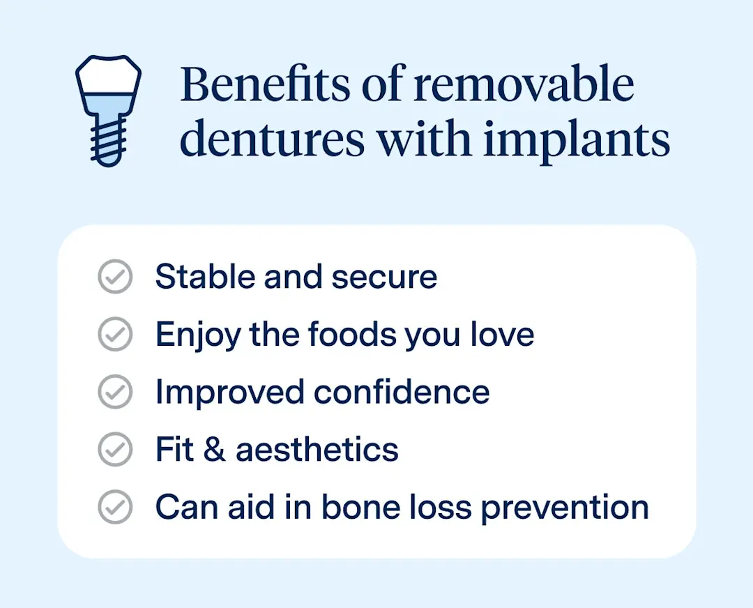 Removable dentures with implants and how they work | Aspen Dental