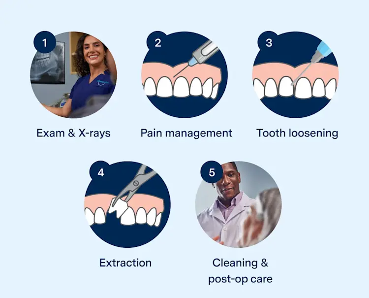 Tooth extraction infection and pain post-removal | Aspen Dental