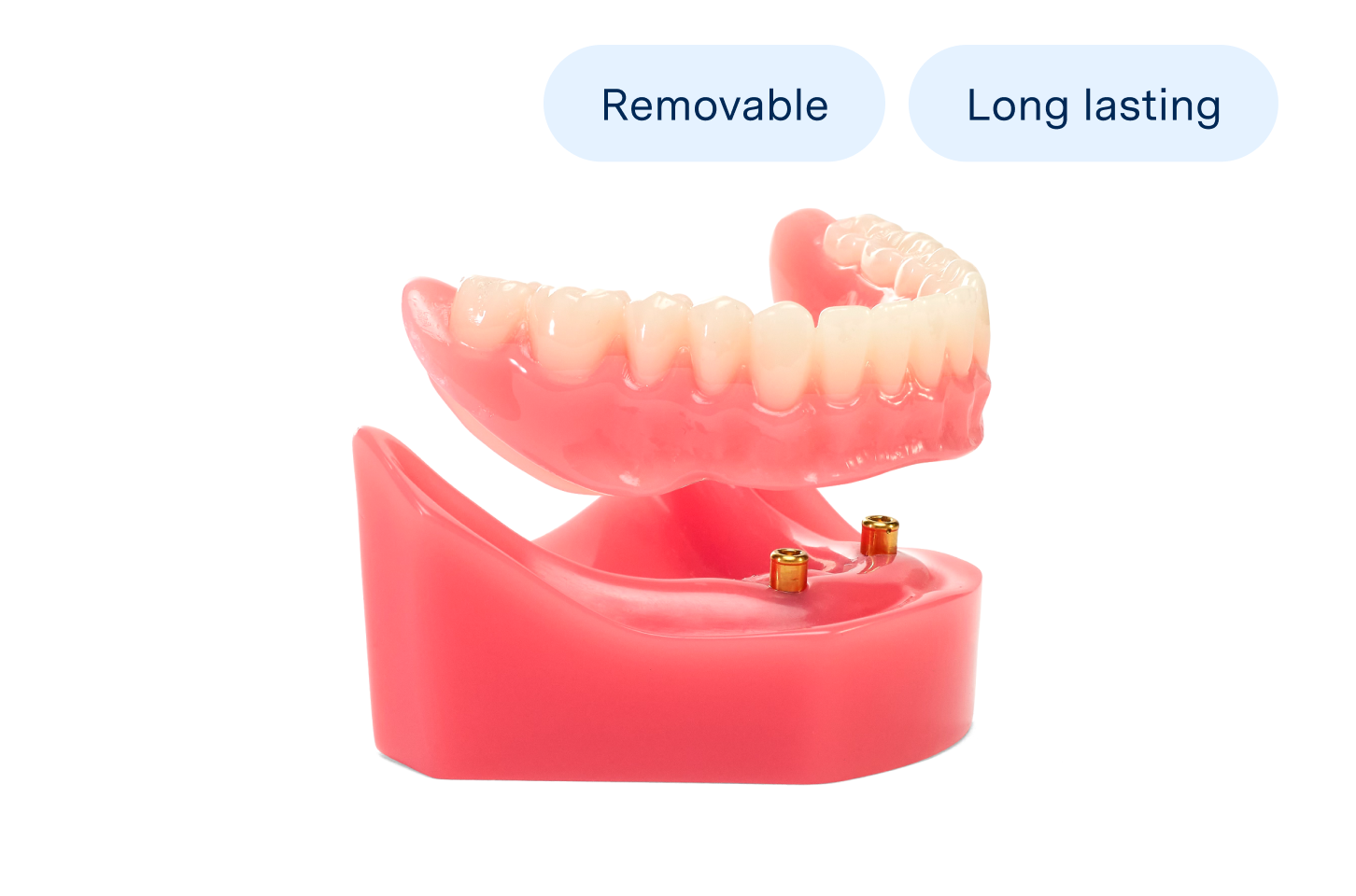 Discover the Best Type of Denture for You | Aspen Dental