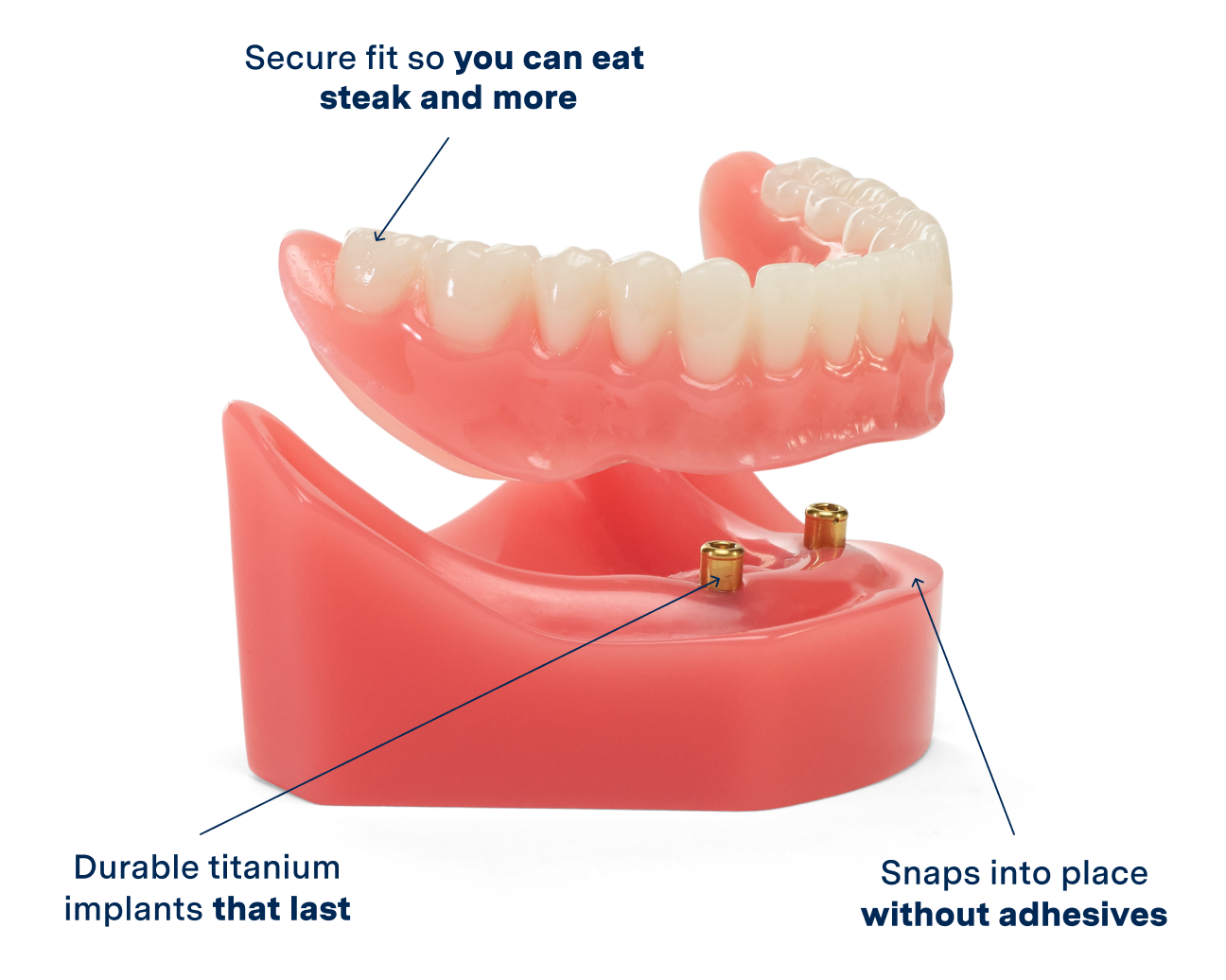 Dentures: Types, Benefits, and Repairs | Aspen Dental
