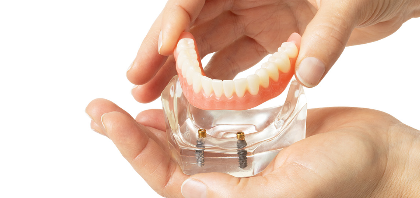 Snap-In & Snap-On Dentures: Affordable Replacement | Aspen Dental