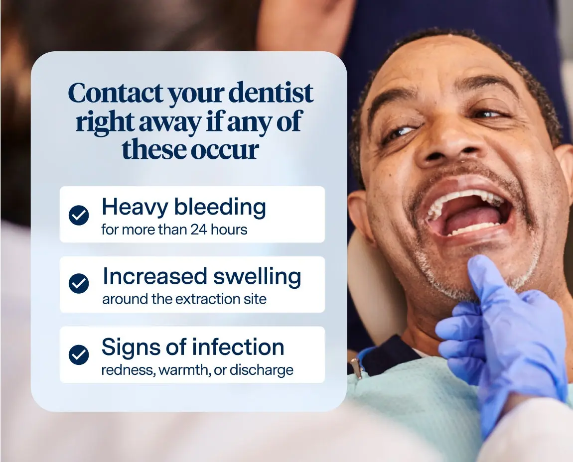How to stop bleeding after a tooth extraction | Aspen Dental