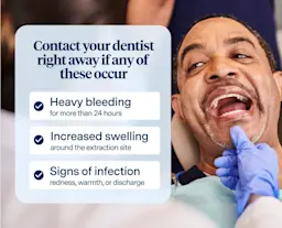 How to stop bleeding after a tooth extraction | Aspen Dental
