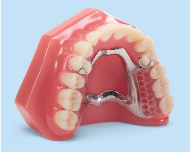 About Dentures and Find Dentures Near You