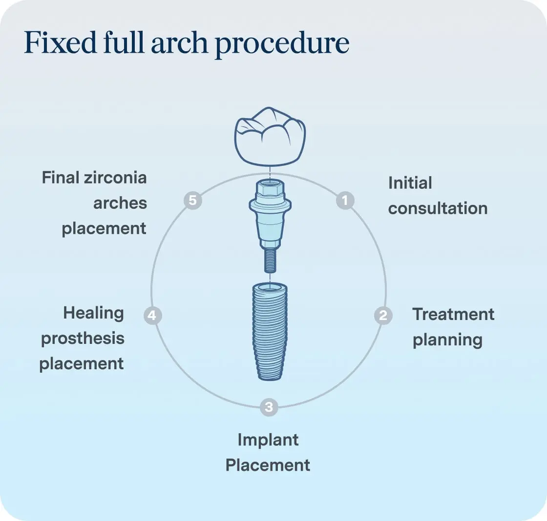 Why choose zirconia arches for fixed full arch dental implants ...