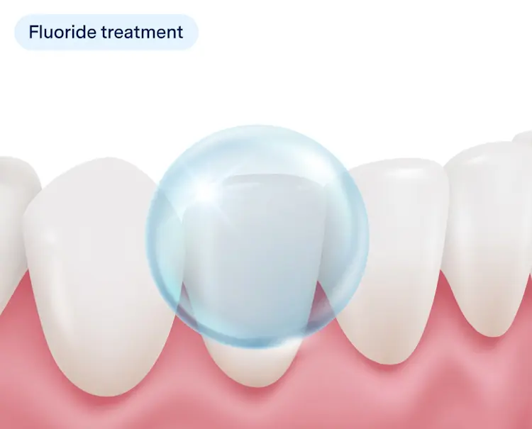 Why do cavities hurt and how can I prevent them? | Aspen Dental