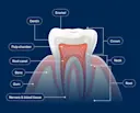 Apicoectomy: root canal surgery explained | Aspen Dental