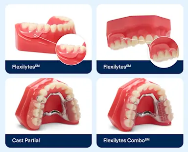 Benefits of upper and lower partial dentures | Aspen Dental
