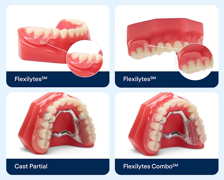 Benefits of upper and lower partial dentures | Aspen Dental