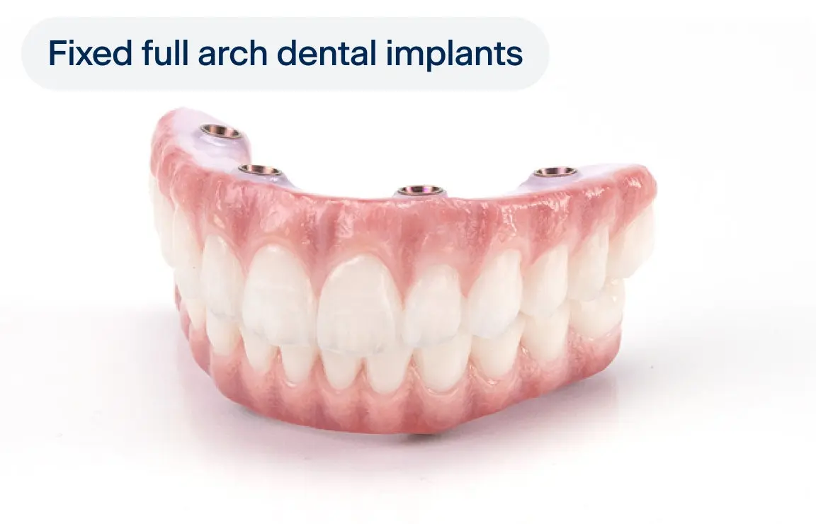 Can I get dental implants if I have dentures? | ClearChoice