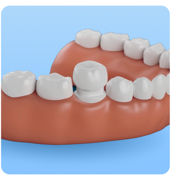 Dental Services In Arnold, MO | Aspen Dental