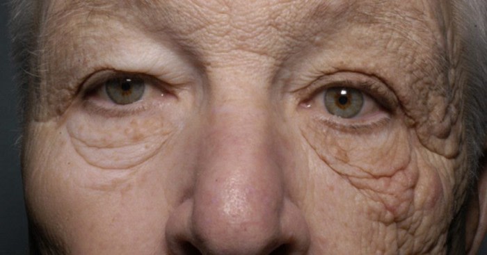 Photos That Will Convince You to Wear Sunscreen Every Day | by Curolog