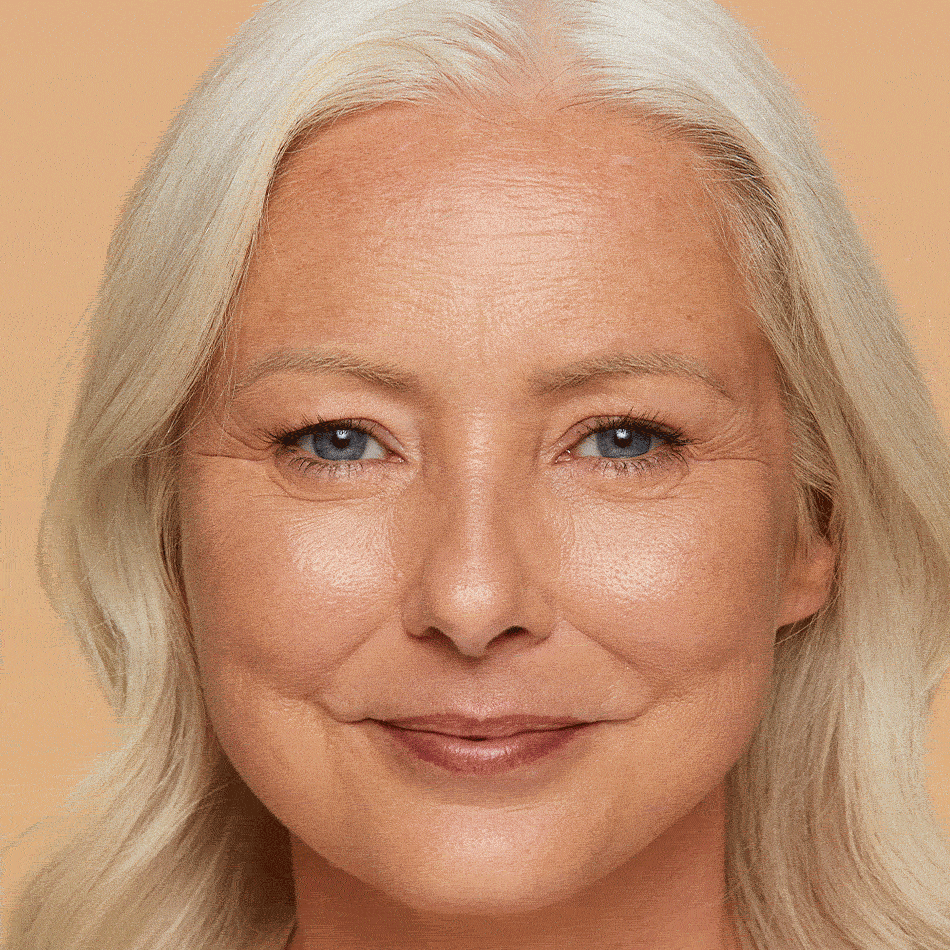 Miracle Blur | Lip and Line Filler