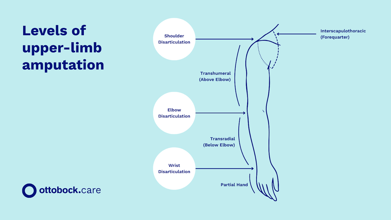 Your Simple Guide to Upper Limb Prosthetics at Ottobock.care