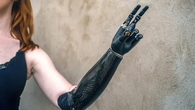 Upper Limb Prosthetics | Personalized Arm Prostheses | Ottobock.care