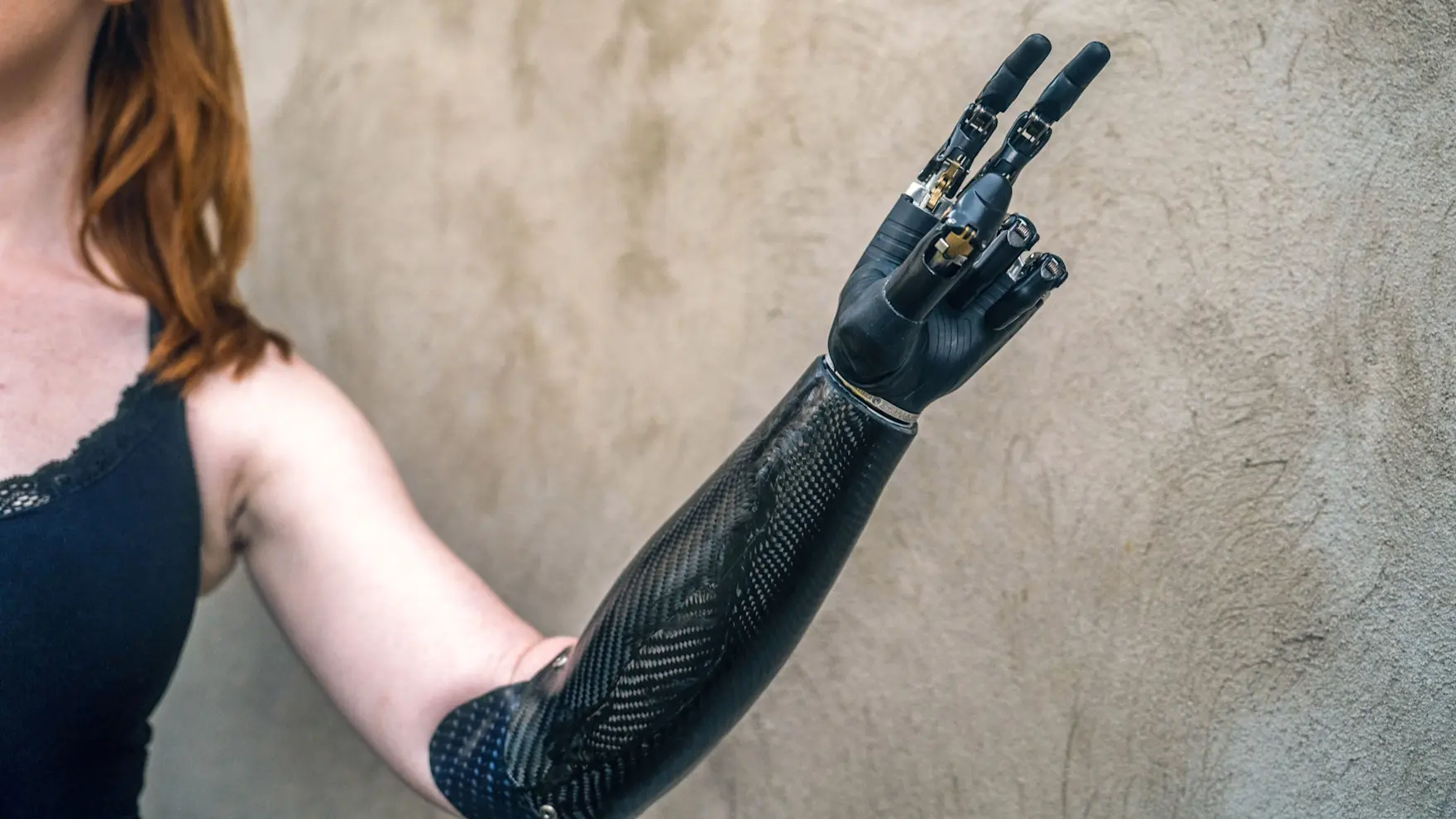 Upper Limb Prosthetics | Personalized Arm Prostheses | Ottobock.care