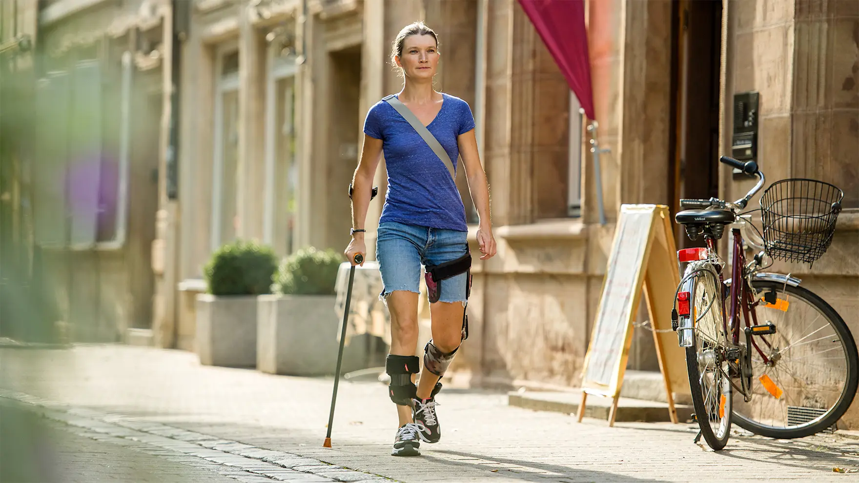 Congenital Limb Difference vs Amputation