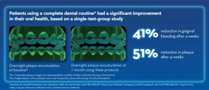 Ortho Essentials - Orthodontic Plaque Removal for Patients | Dentalcare.ca