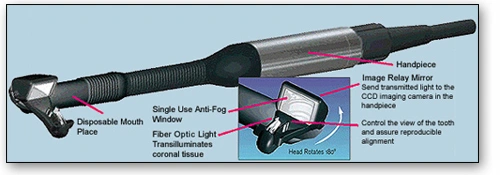 Fiber-Optic Transillumination | dentalcare.en-ca