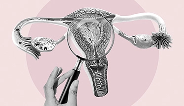 Menstruación marrón y escasa: ¿Qué significa? - Nosotras