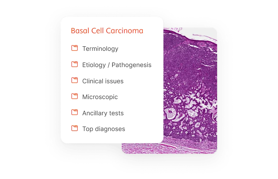 Diagnostic decision support for pathology | ExpertPath | Elsevier