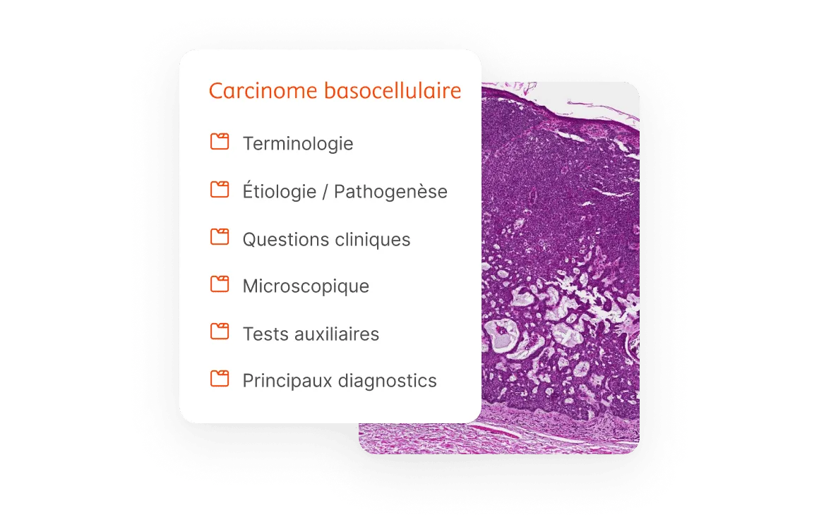 Aide à la décision clinique pour la pathologie | ExpertPath | Elsevier