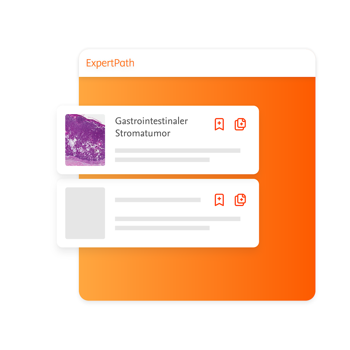 Diagnostische Entscheidungshilfe für die Pathologie | ExpertPath | Elsevier